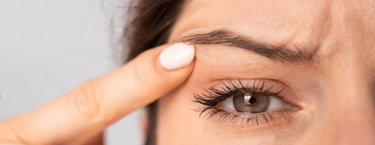 Understanding Droopy Eyelids | Sweeney Eye Associates